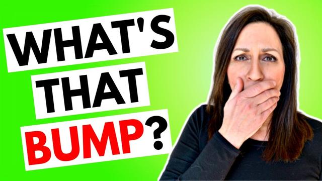 Understanding Seromas in Dogs: Symptoms and Visuals